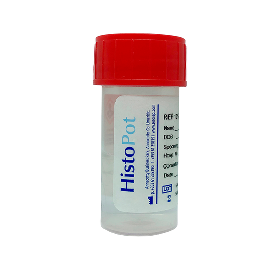 Frasco com Formol - Material de Consumo